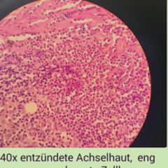 Entzündungsmediator - DocCheck Flexikon