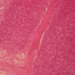 Trabekel - DocCheck Flexikon