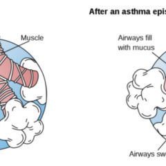 Atemwege - DocCheck Flexikon