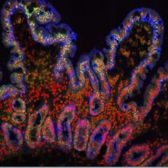 Zotte - DocCheck Flexikon