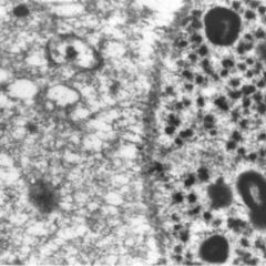 Stratum nucleare internum - DocCheck Flexikon