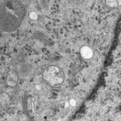 Cisterna basalis - DocCheck Flexikon