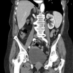 Kaudal - DocCheck Flexikon