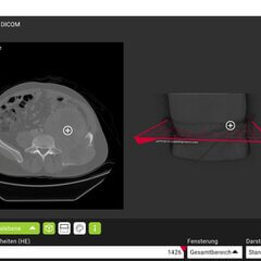 DICOM-Viewer - DocCheck Flexikon