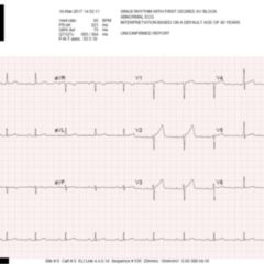 Trisomie 22 - DocCheck Flexikon