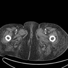 Oberschenkel - DocCheck Flexikon