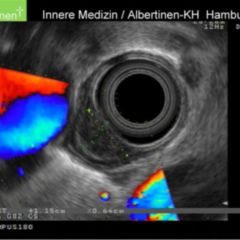 Plattenepithel - DocCheck Flexikon