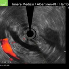 Ductus parotideus - DocCheck Flexikon