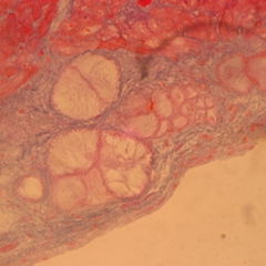 Endokard - DocCheck Flexikon