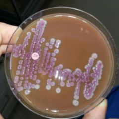 Serratia - DocCheck Flexikon
