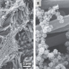 Flimmerepithel - DocCheck Flexikon
