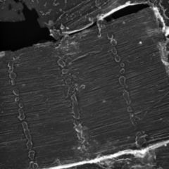 Myofibrille - DocCheck Flexikon