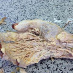 Canalis nervi facialis - DocCheck Flexikon