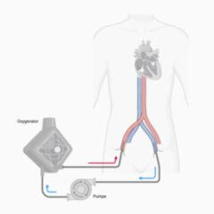 Extrakorporale Reanimation - DocCheck Flexikon