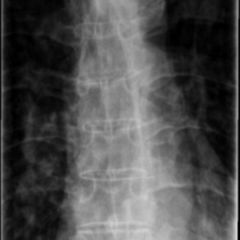 Brustwirbelsäule - DocCheck Flexikon