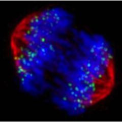Mitose - DocCheck Flexikon