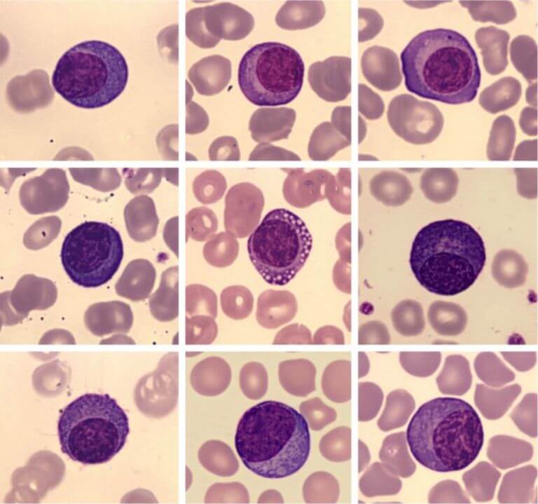 Plasmazellen - DocCheck