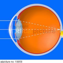 Augenkammer - DocCheck Flexikon