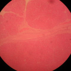 Arteria interlobularis - DocCheck Flexikon