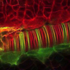 Neuralrohr - DocCheck Flexikon