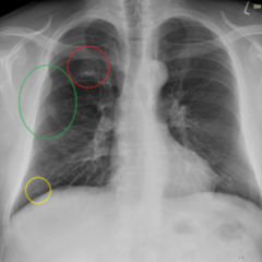 Rippe - DocCheck Flexikon