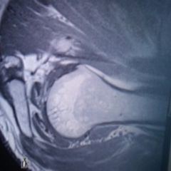 Virom - DocCheck Flexikon