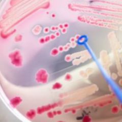 Enterococcus faecium - DocCheck Flexikon