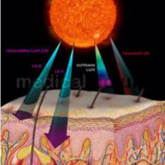 Strahl - DocCheck Flexikon