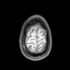 Gyrus postcentralis - DocCheck Flexikon