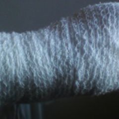 Urinstatus - DocCheck Flexikon