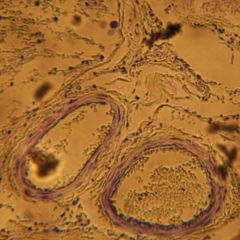 Pseudounipolare Nervenzelle - DocCheck Flexikon