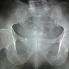 Symphyse - DocCheck Flexikon