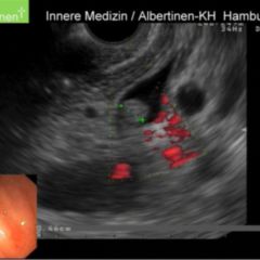 Ductus parotideus - DocCheck Flexikon