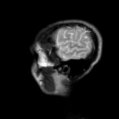 Sagittalebene - DocCheck Flexikon