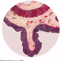 Plica duodenalis superior - DocCheck Flexikon