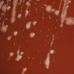 Eiter - DocCheck Flexikon