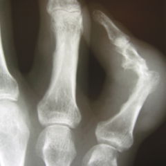 Xanthinoxidase - DocCheck Flexikon