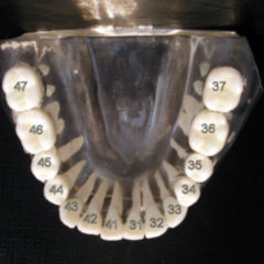 Schneidezahn - DocCheck Flexikon