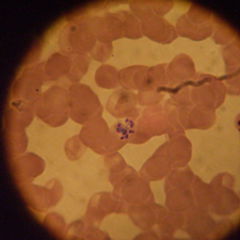 Sporozoit - DocCheck Flexikon