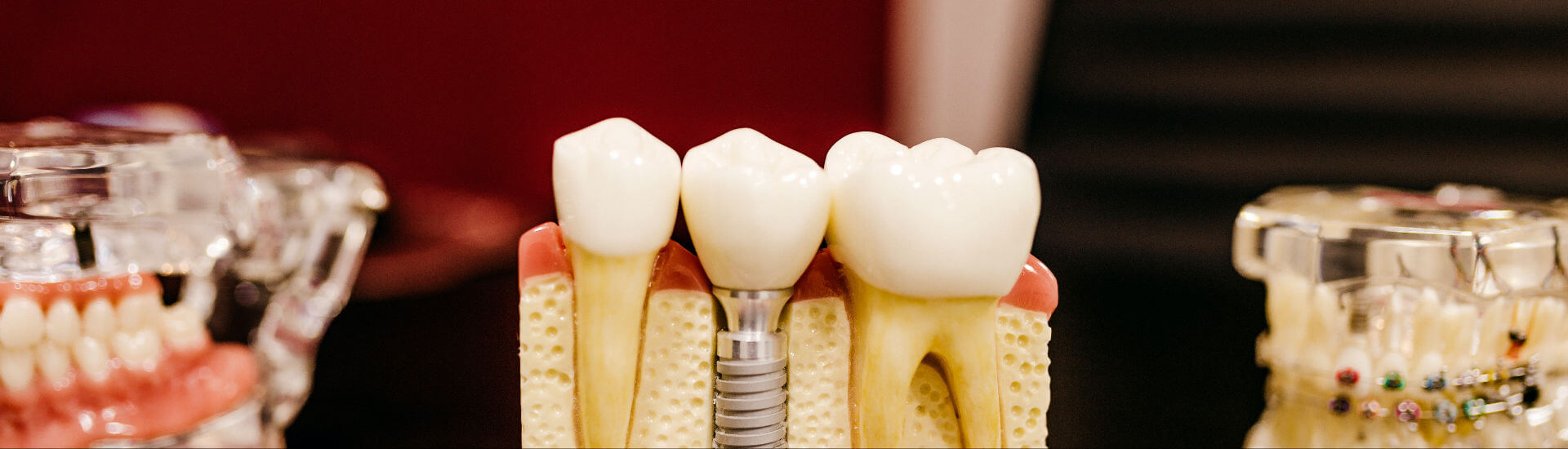 New Teeth, New Me: Tooth Enamel Restored - DocCheck