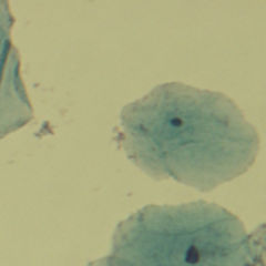 Vaginalsekret - DocCheck Flexikon