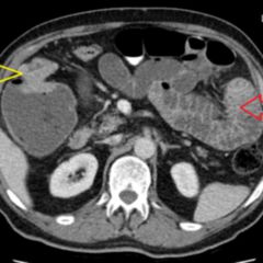 Flexur - DocCheck Flexikon