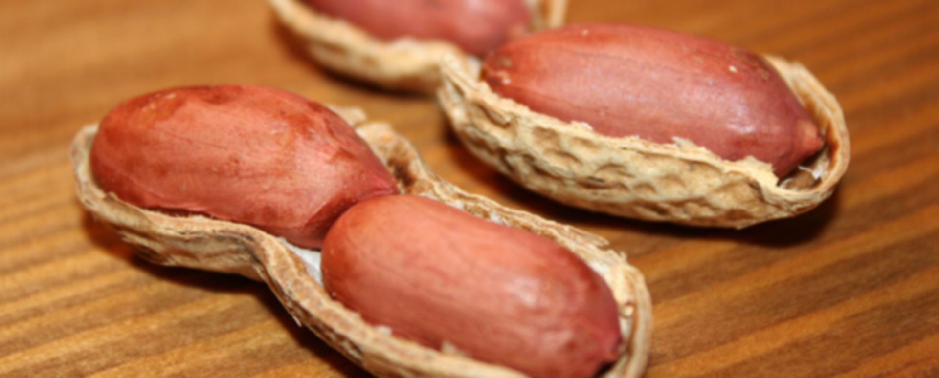 Allergien: Ist Nuss drin, wo Nuss draufsteht? - DocCheck Allergien: Ist Nuss drin, wo Nuss draufsteht? - DocCheck