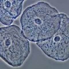 Epithelial - DocCheck Flexikon