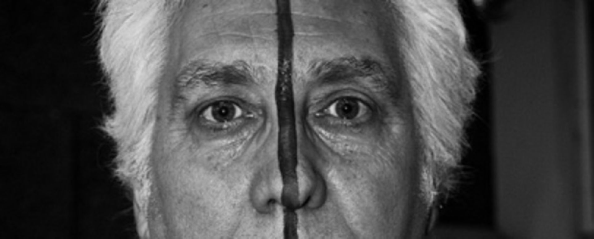 Split-Brain-Patienten - DocCheck