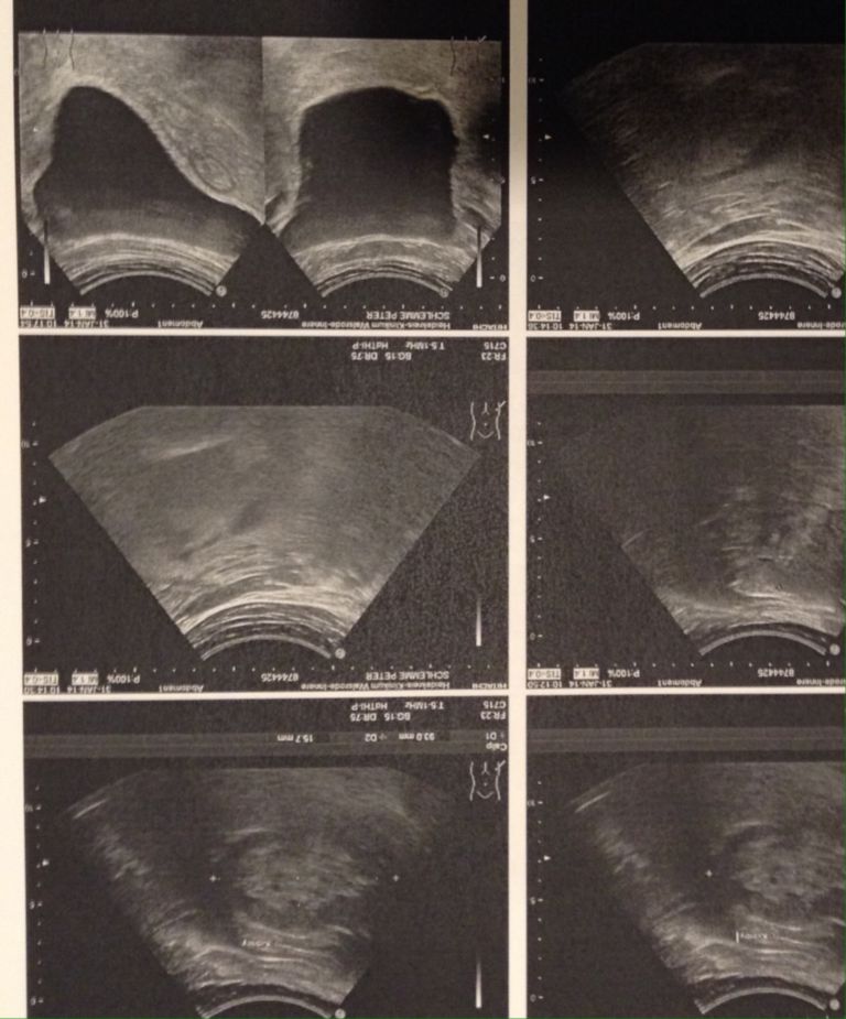 Ultraschall - DocCheck