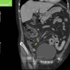 Meso - DocCheck Flexikon