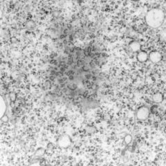 Polysom - DocCheck Flexikon