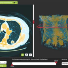 DICOM-Viewer - DocCheck Flexikon