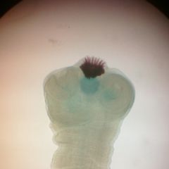 Taenia solium - DocCheck Flexikon